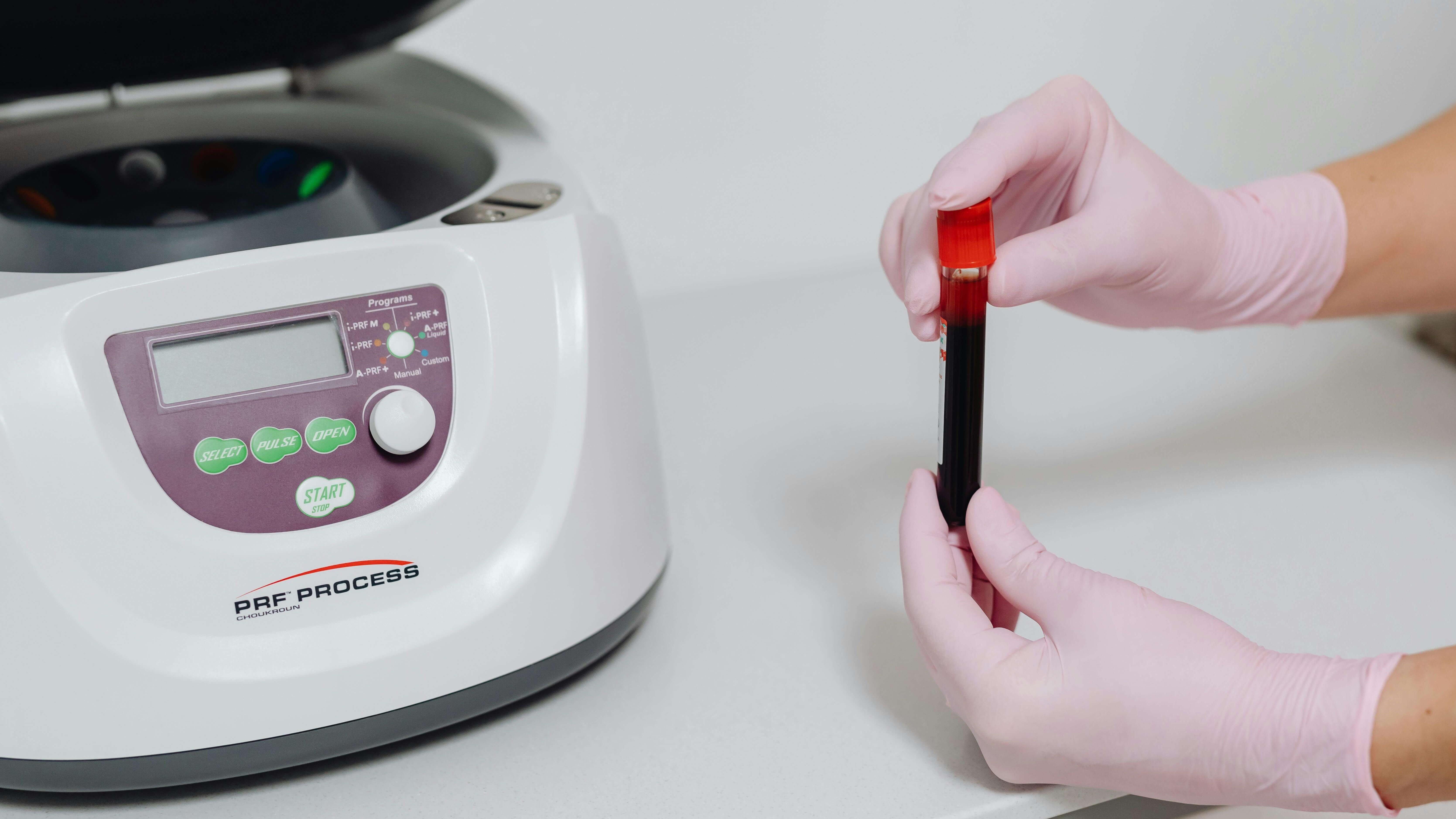 Understanding FSH Levels and What They Mean for Fertility